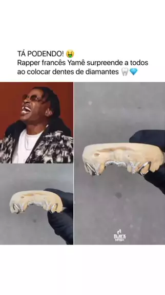 rapper francês sem dentes | Discover