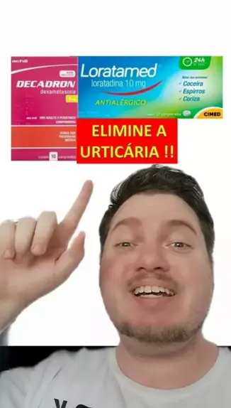 Treatment for Urticaria: Antihistamines and Cortic ...| Kwai